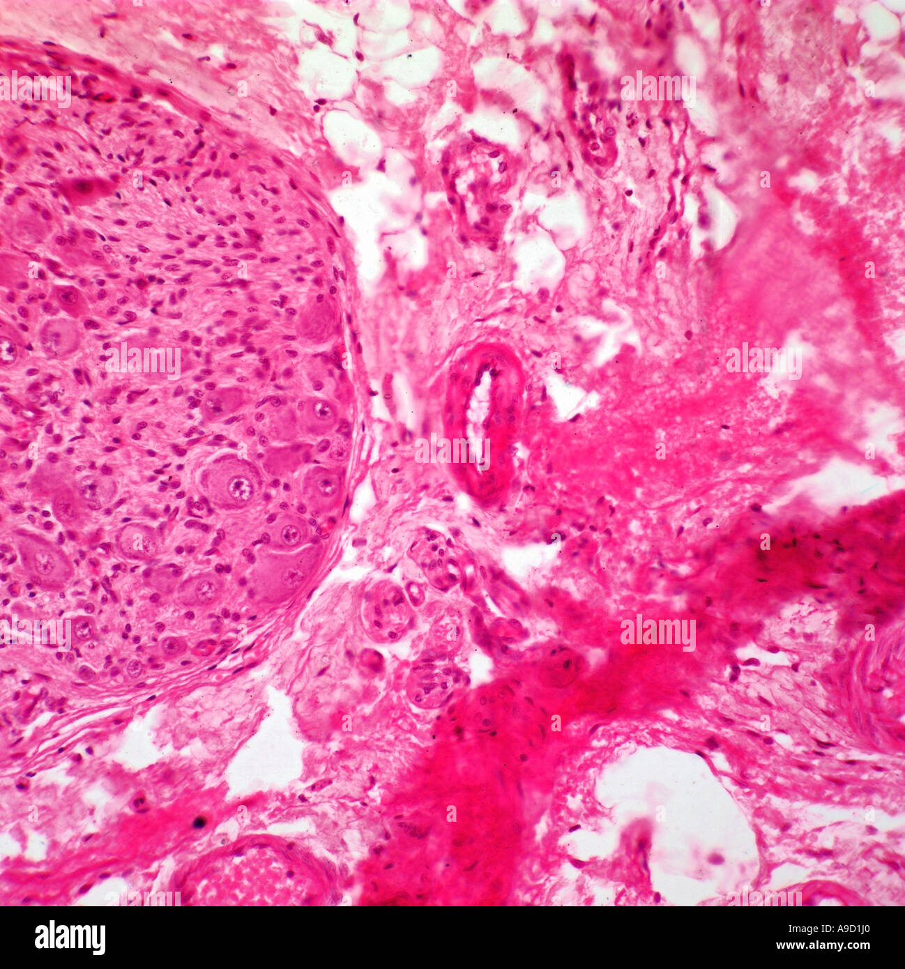 Human suprarenal capsule detail Stock Photo - Alamy