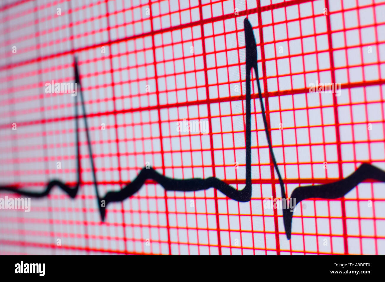 multiple Electrocardiogram EKG symbols on monitor screen and grid Stock ...