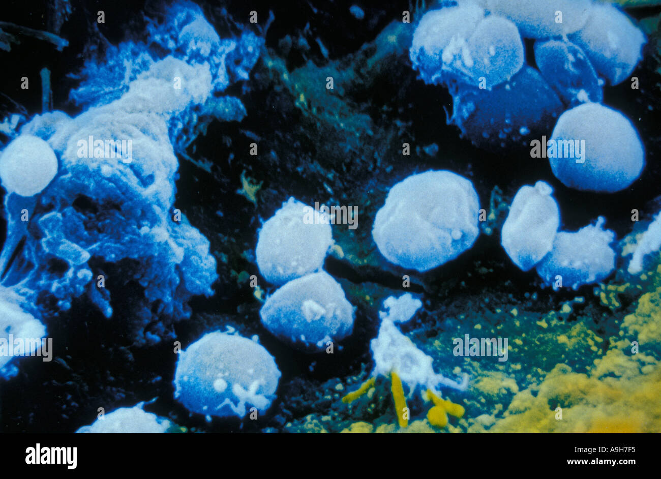 Human Micro biology Scanning electron micrograph of bone marrow 1 94 8 ...