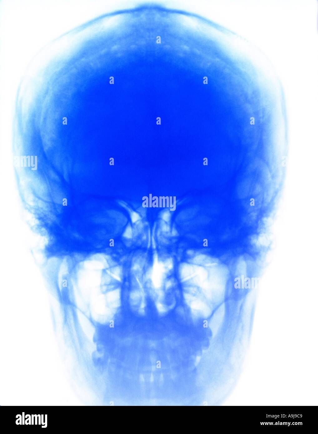 X ray test objects hi-res stock photography and images - Alamy