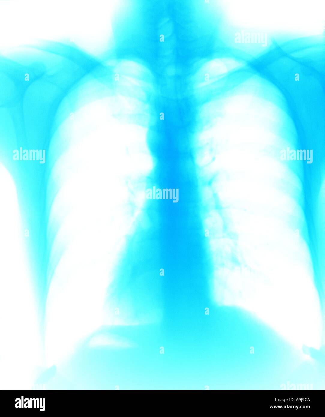 X ray test objects hi-res stock photography and images - Alamy