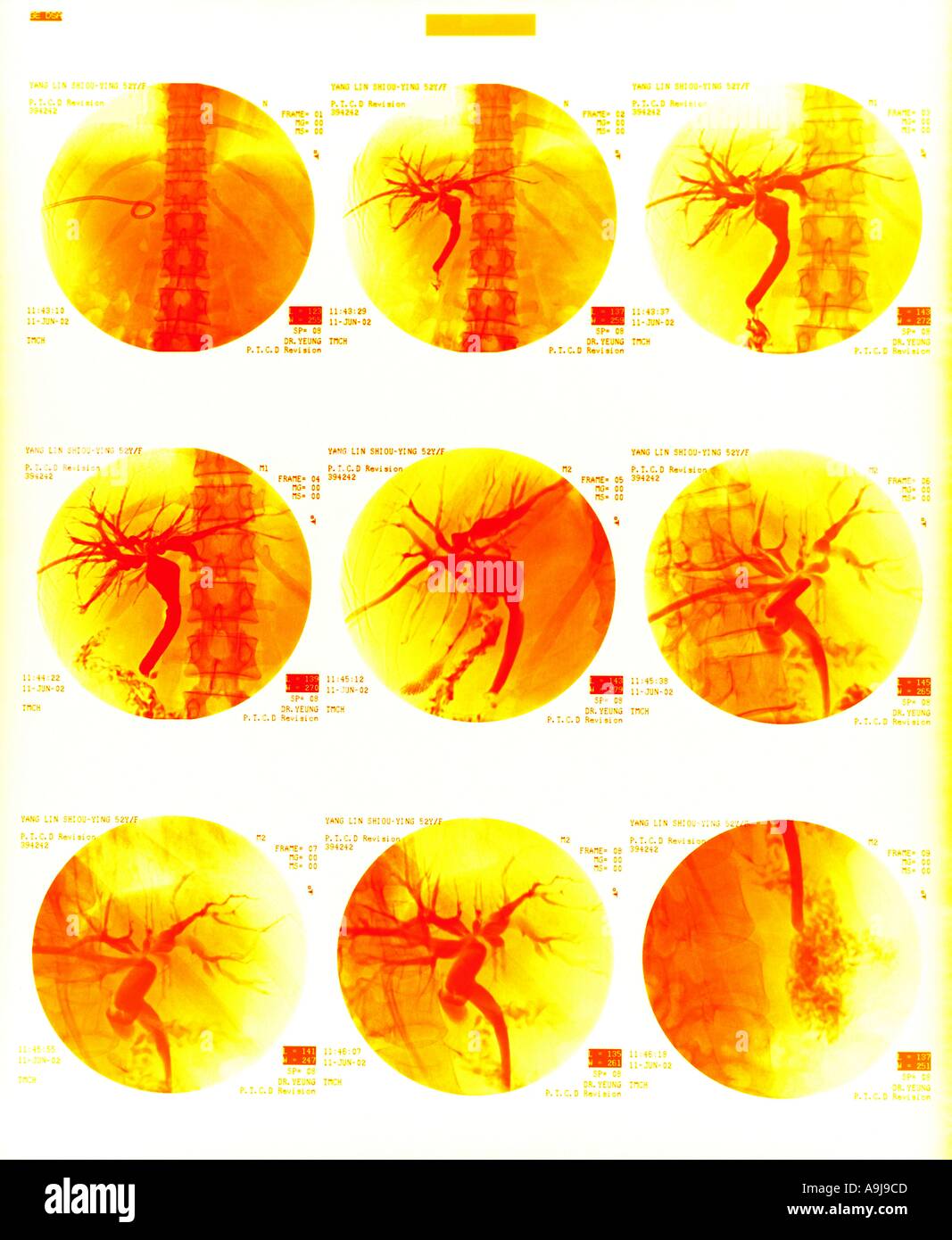 X ray test objects hi-res stock photography and images - Alamy