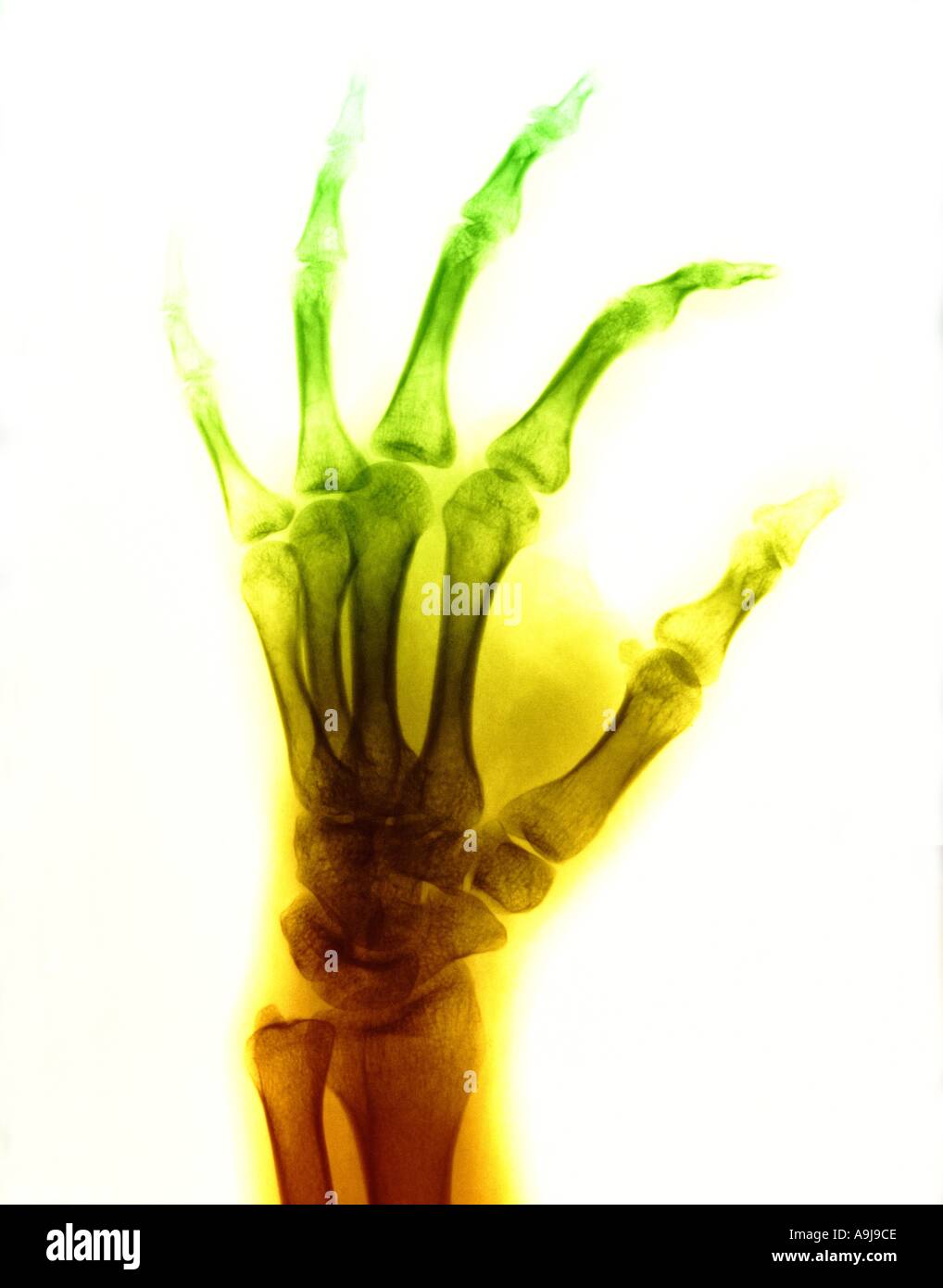 X ray test objects hi-res stock photography and images - Alamy