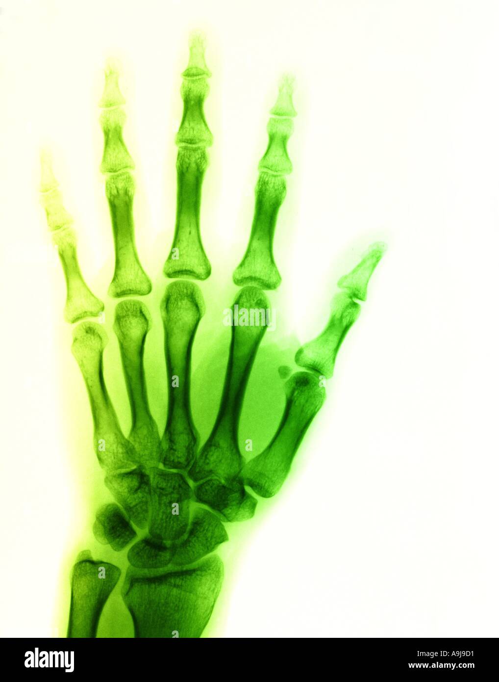 X ray test objects hi-res stock photography and images - Alamy