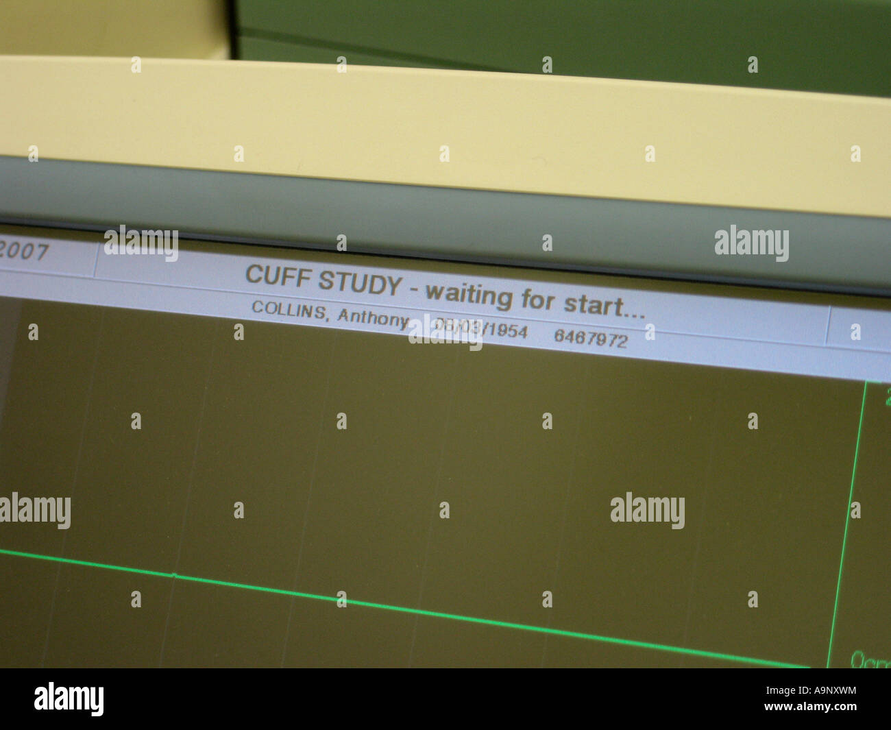 Monitor screen showing trace of new noninvasive bladder pressure cuff ...