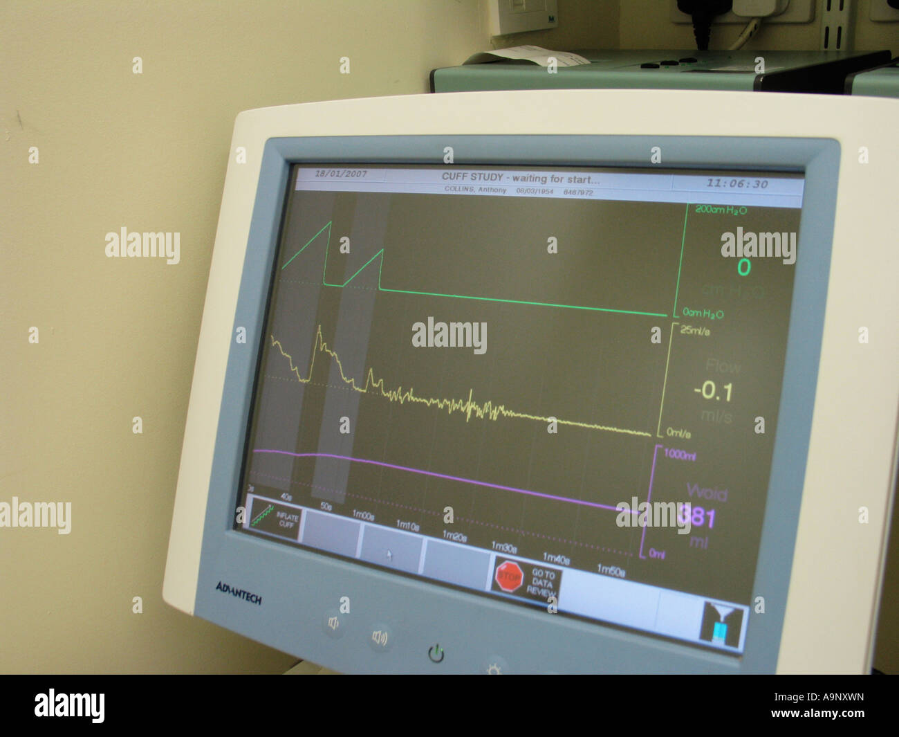 Monitor screen showing trace of new noninvasive bladder pressure cuff ...
