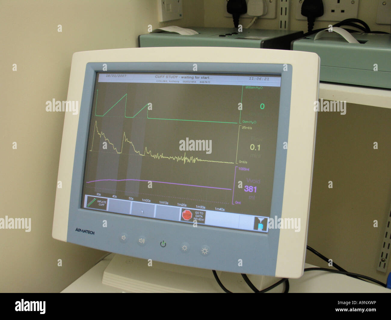 Monitor screen showing trace of new noninvasive bladder pressure cuff ...