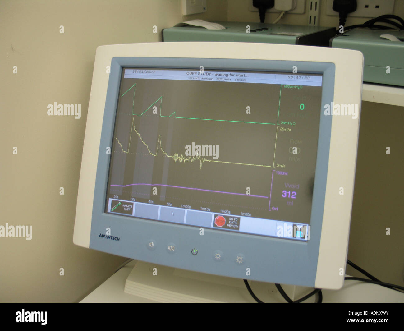 Monitor screen showing trace of new noninvasive bladder pressure cuff ...