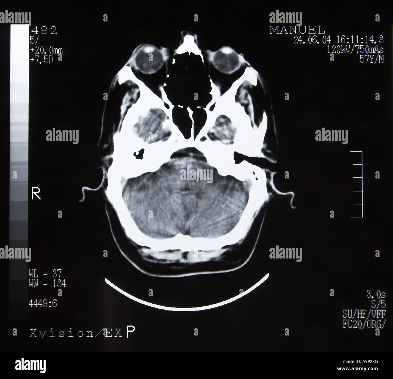 Cat brain anatomy hi-res stock photography and images - Alamy