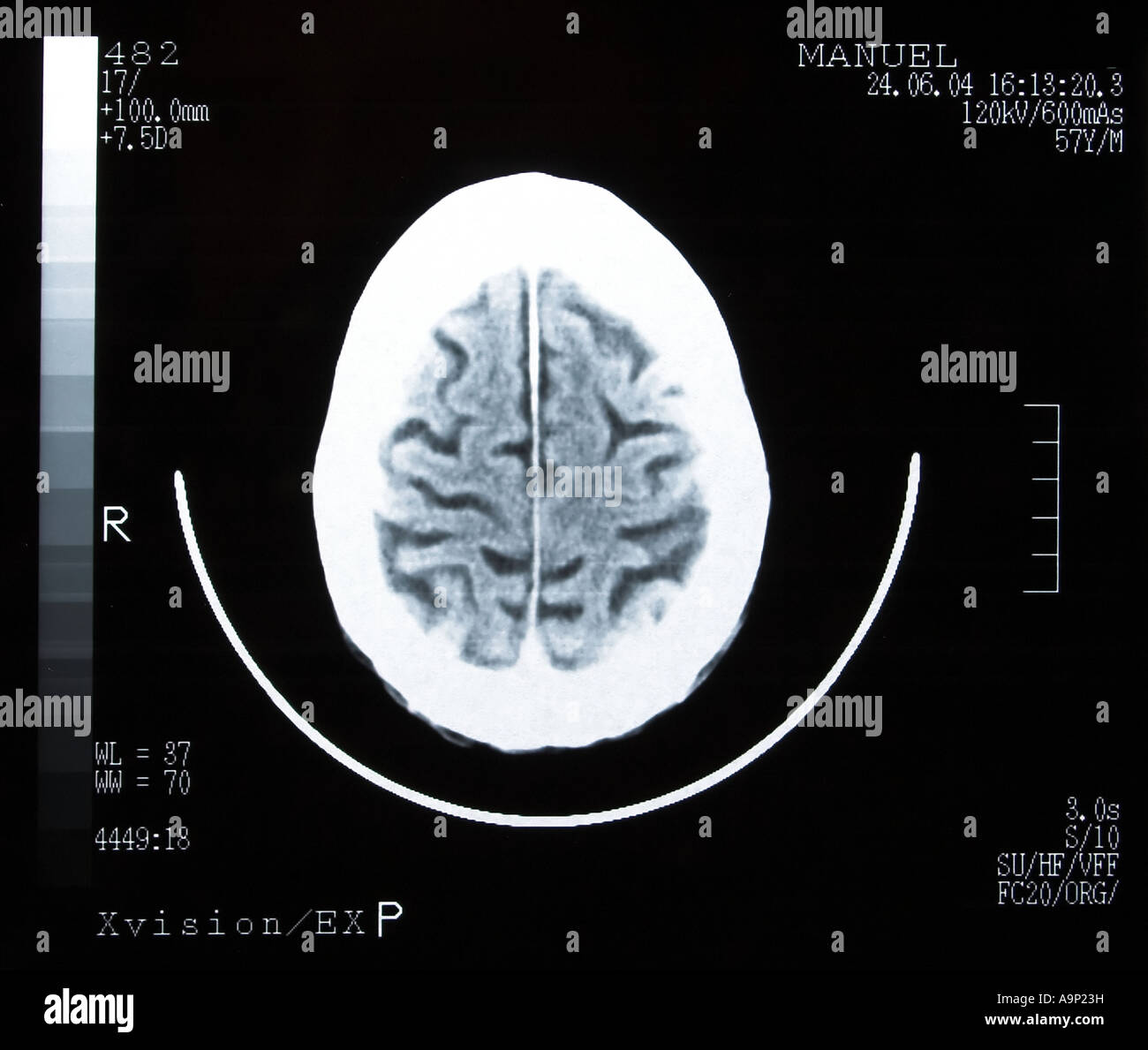 Cat brain anatomy hi-res stock photography and images - Alamy