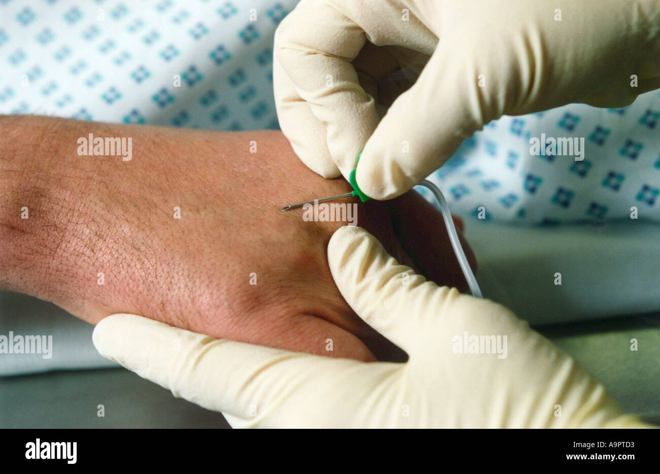 Venepuncture cannulation hi-res stock photography and images - Alamy