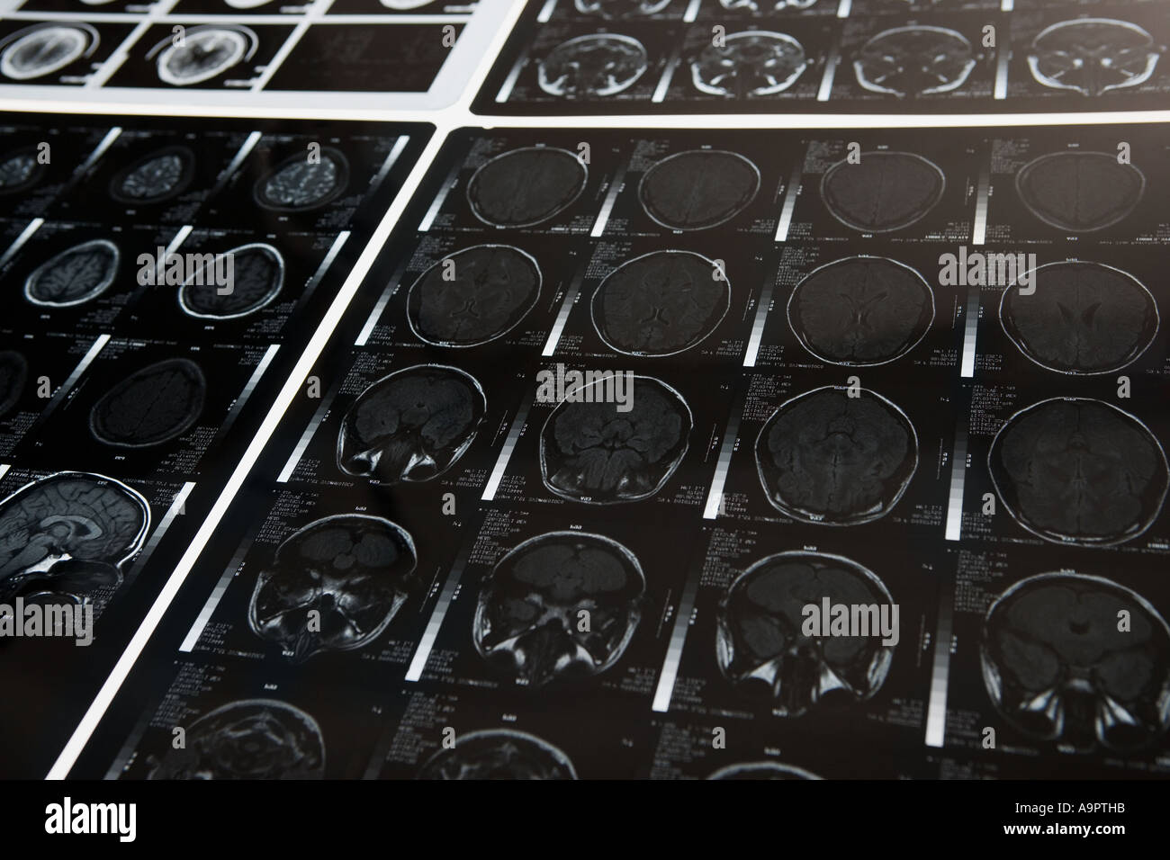 X rays and scans hi-res stock photography and images - Alamy