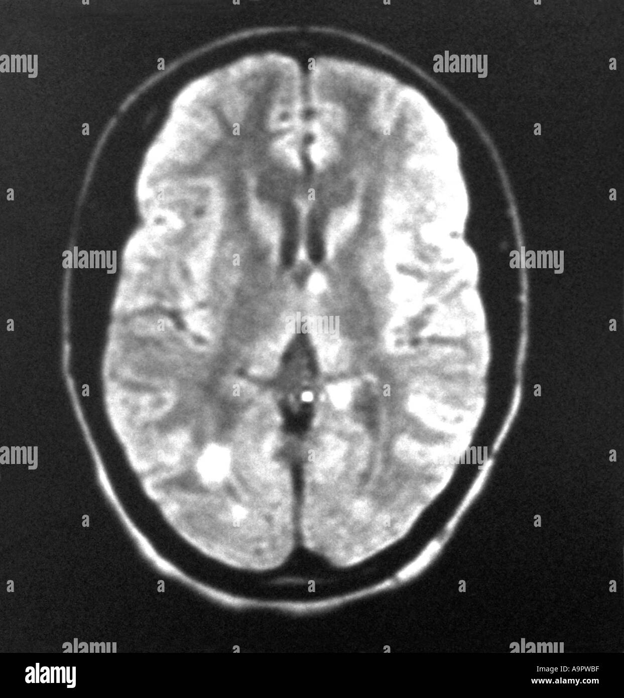Mri scan nmr nuclear hi-res stock photography and images - Alamy