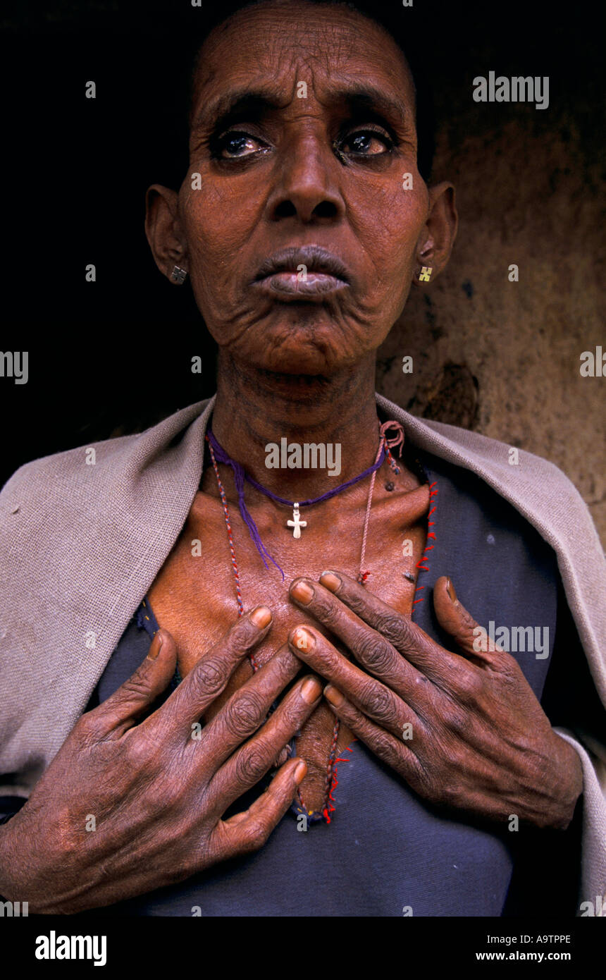 Starving African Man