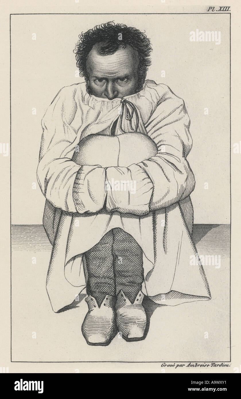 Medical Insanity Patient Stock Photo - Alamy