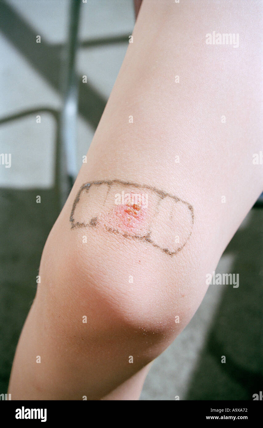 Ouch plaster hi-res stock photography and images - Alamy