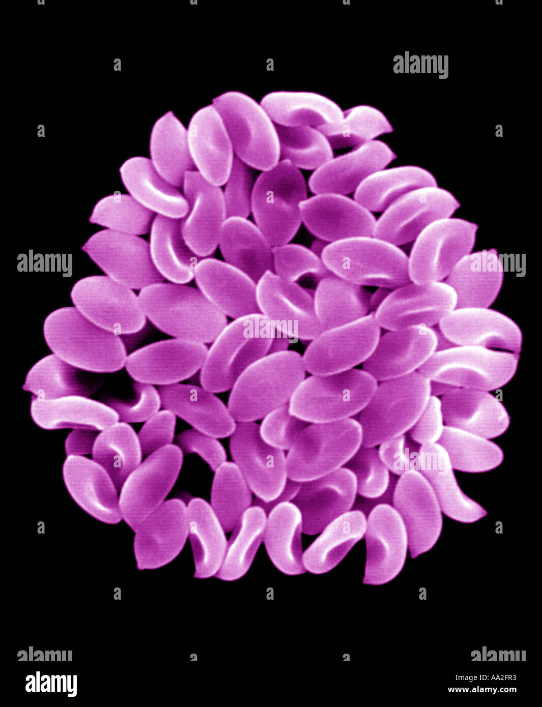 scanning electron micrograph of mushroom spore Stock Photo - Alamy