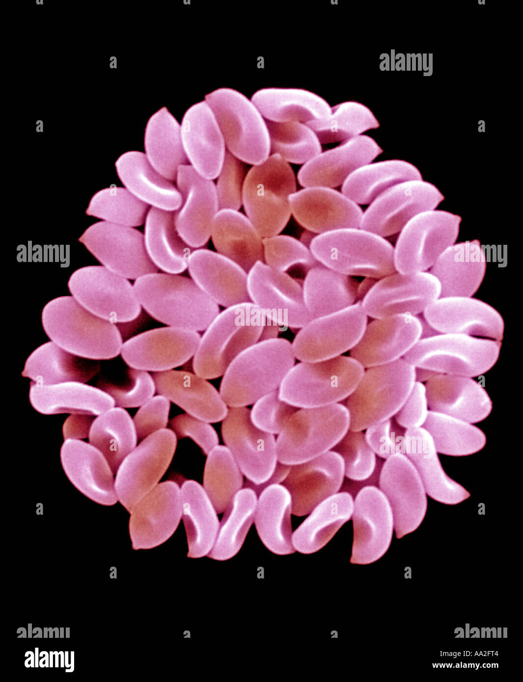 scanning electron micrograph of mushroom spore Stock Photo - Alamy