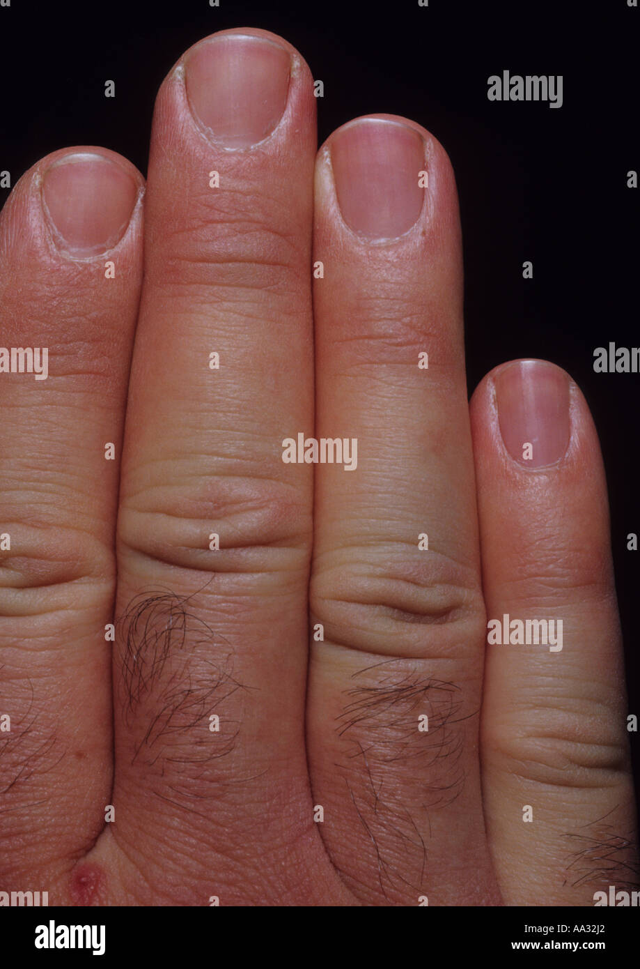 Mans finger nails hi-res stock photography and images - Alamy