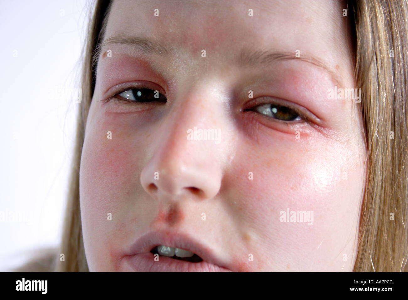 Cried face hi-res stock photography and images - Alamy