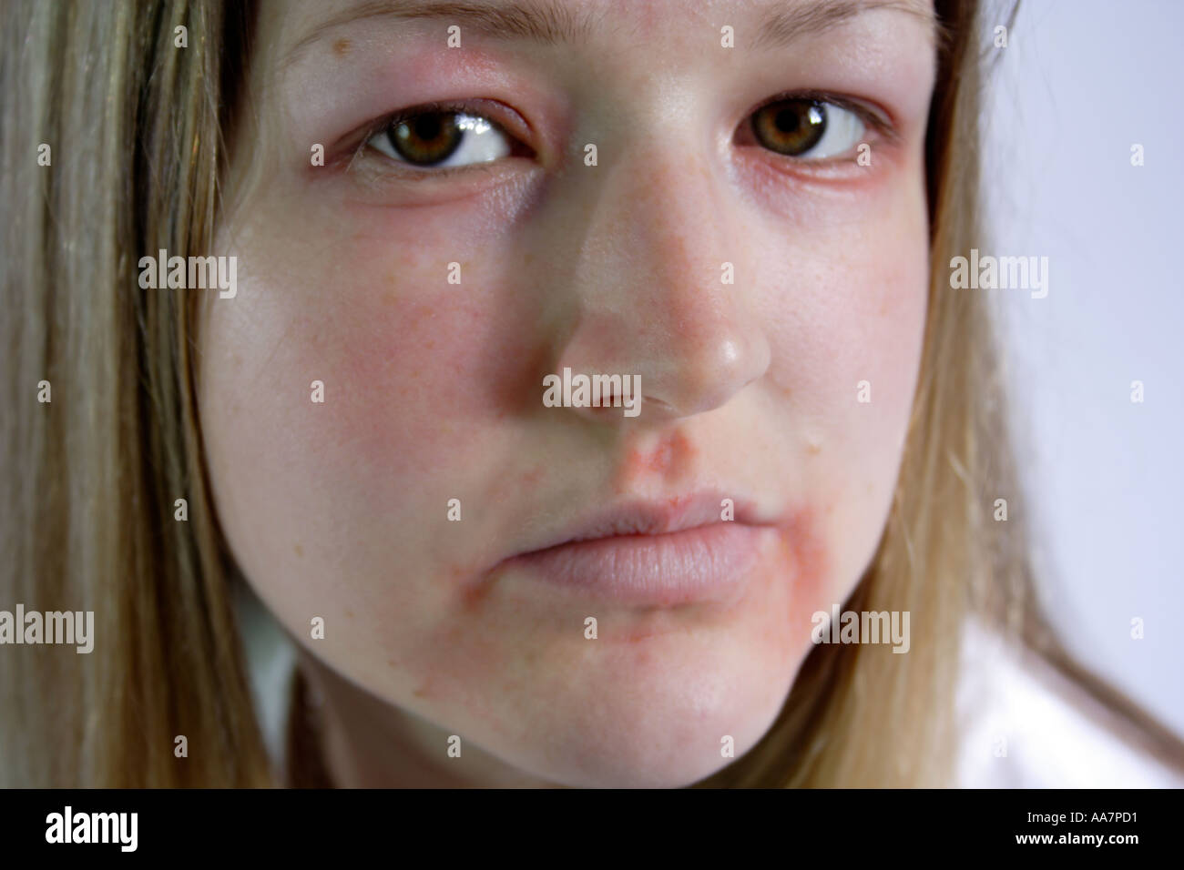 Looking anguished hi-res stock photography and images - Alamy