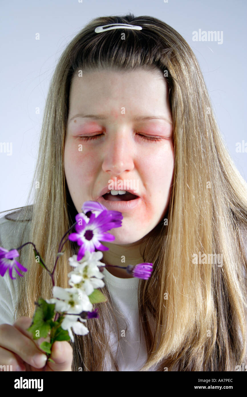 Allergic reaction face hi-res stock photography and images - Alamy