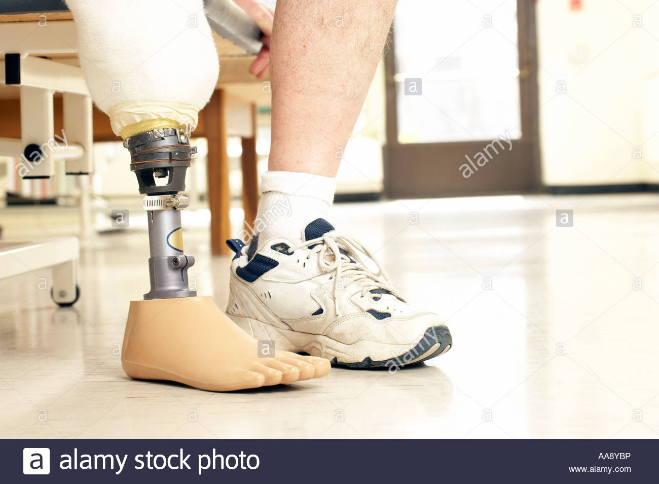 Leg Amputee Stock Photos & Leg Amputee Stock Images - Alamy