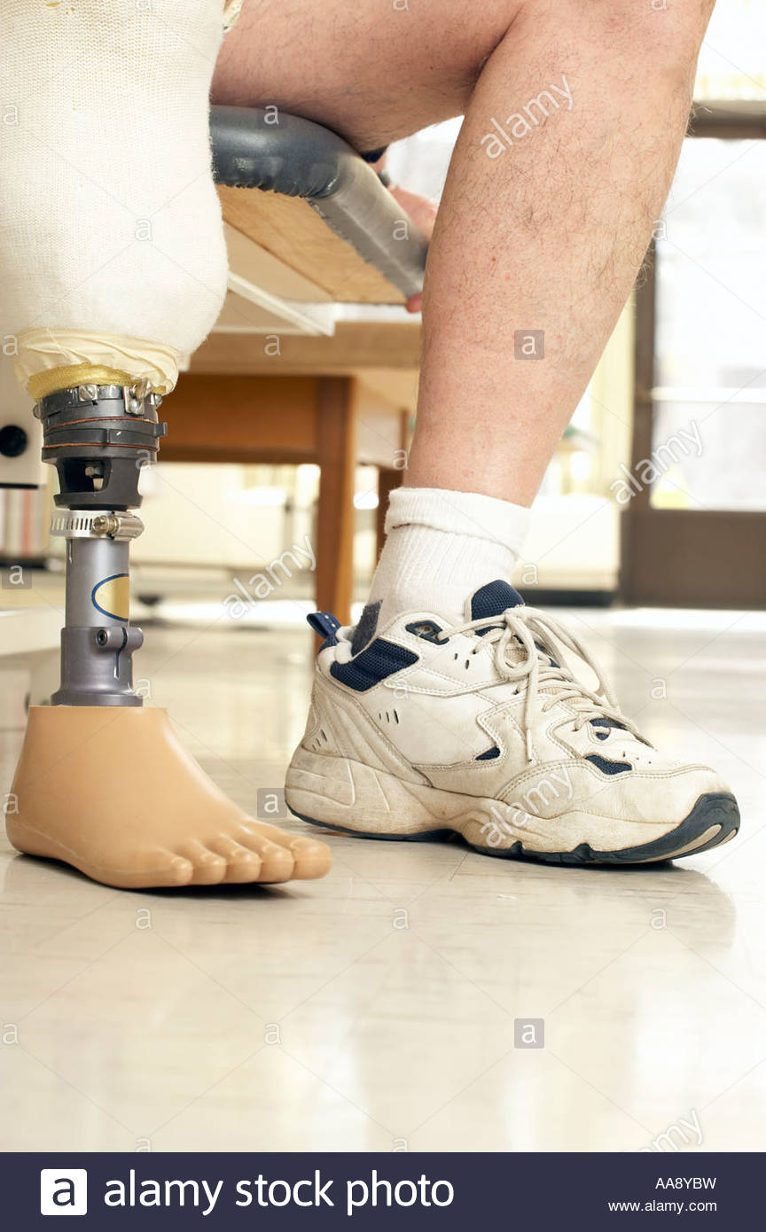 Leg Amputee Stock Photos & Leg Amputee Stock Images - Alamy