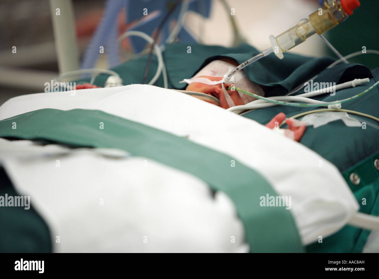 Device for artificial respiration hi-res stock photography and images ...