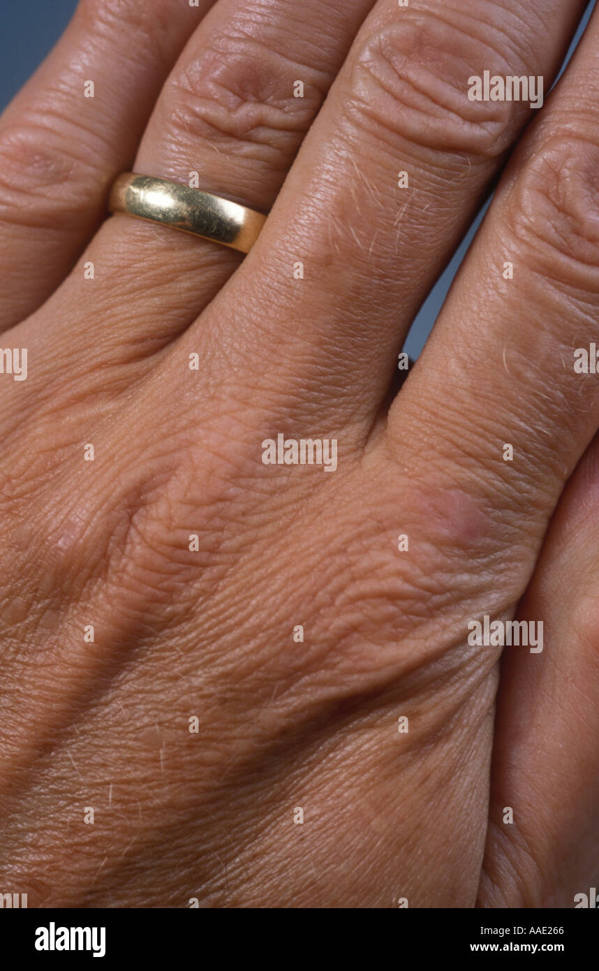 Hand close up Stock Photo - Alamy