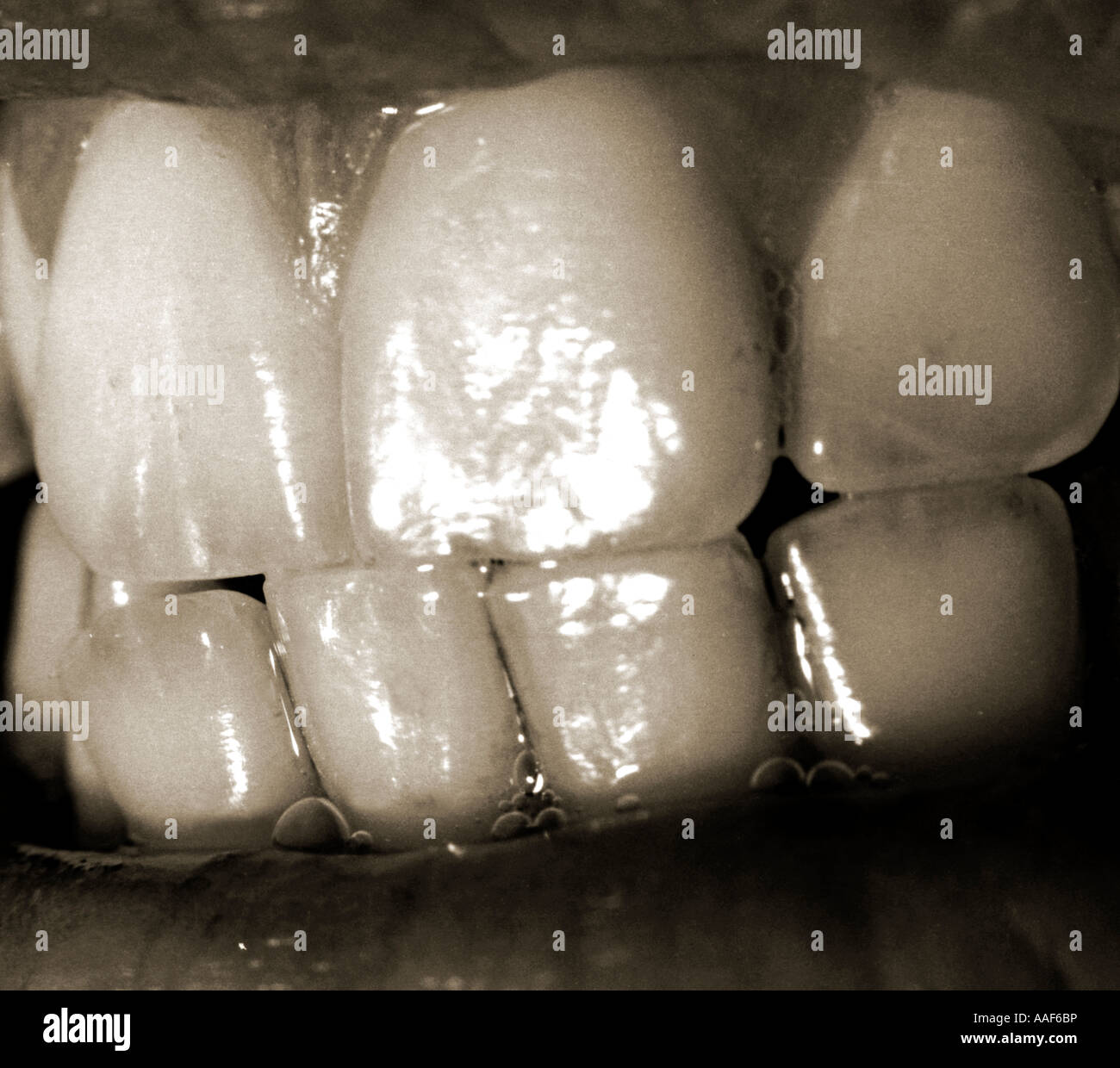 Incisors teeth human hi-res stock photography and images - Alamy