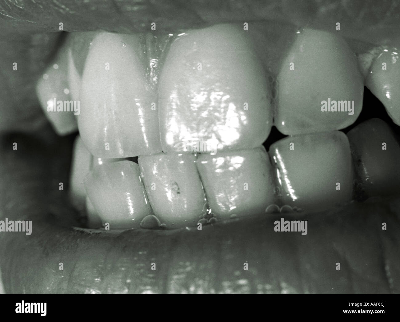 Densitry hi-res stock photography and images - Alamy