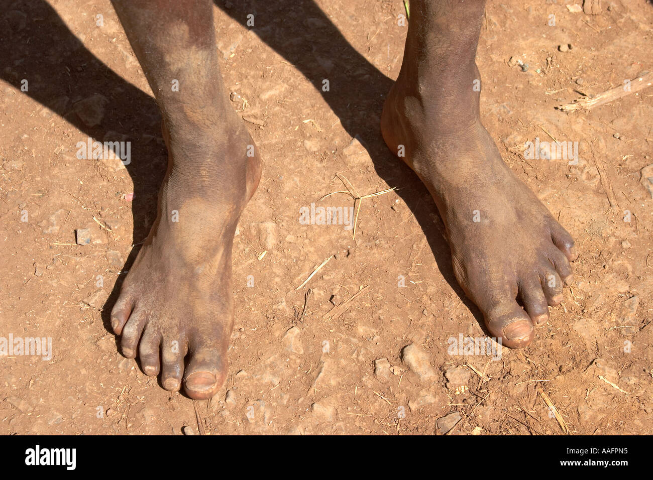 Bare feet of young boy on earth road in Finote Selam Ethiopa Africa ...