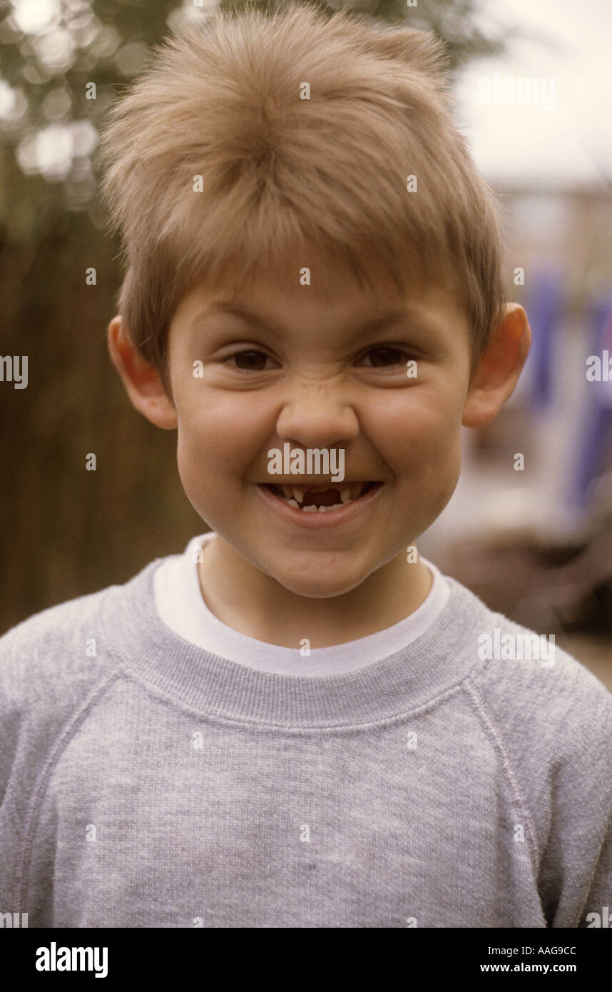 Teeth missing hi-res stock photography and images - Alamy