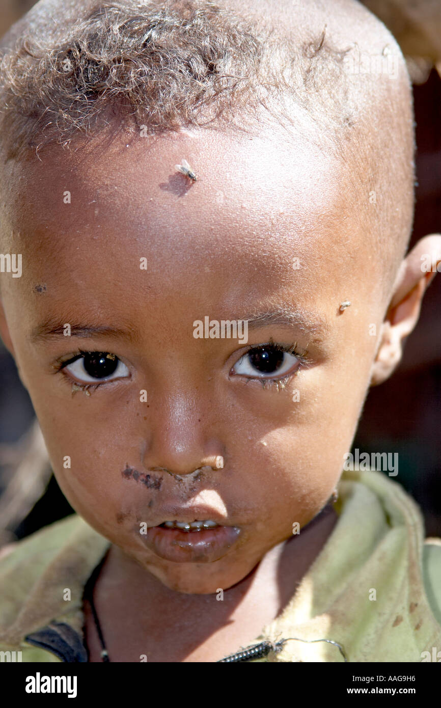 Young boy child with snot and flies on his face in Kuch village ...
