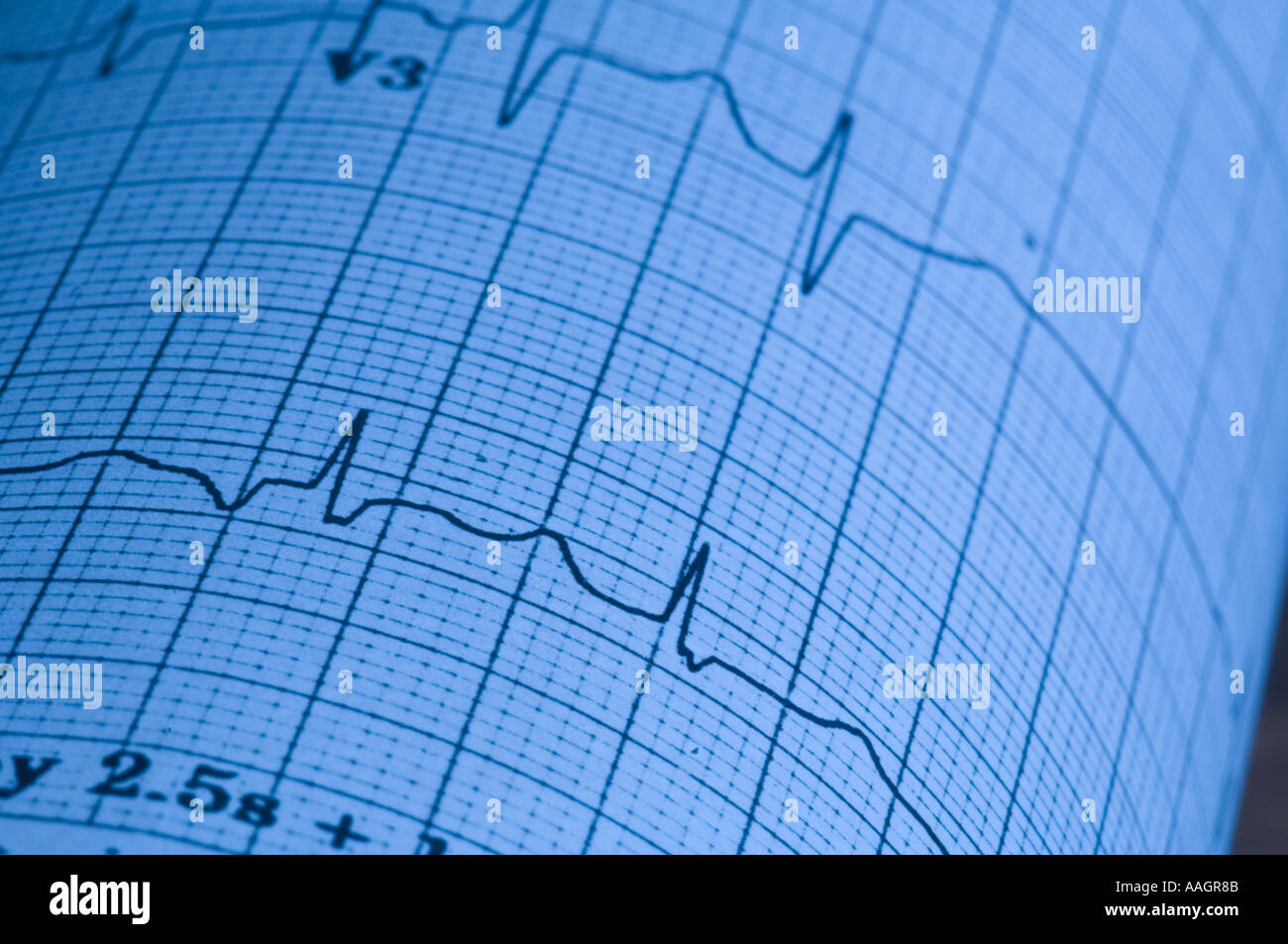 abstract EKG electrocardiogram closeup view Stock Photo - Alamy