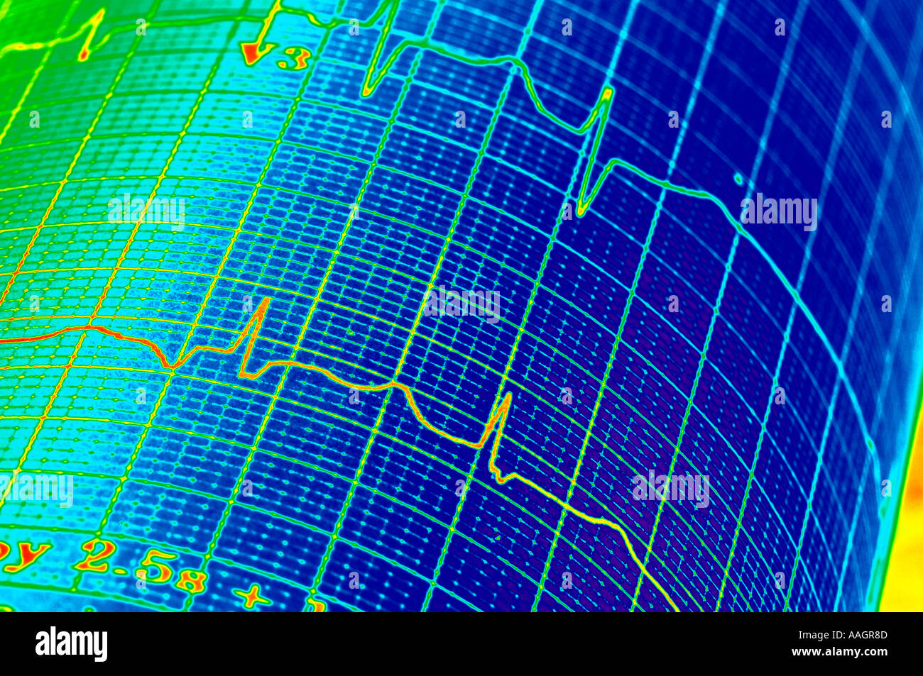 abstract EKG electrocardiogram closeup view Stock Photo - Alamy