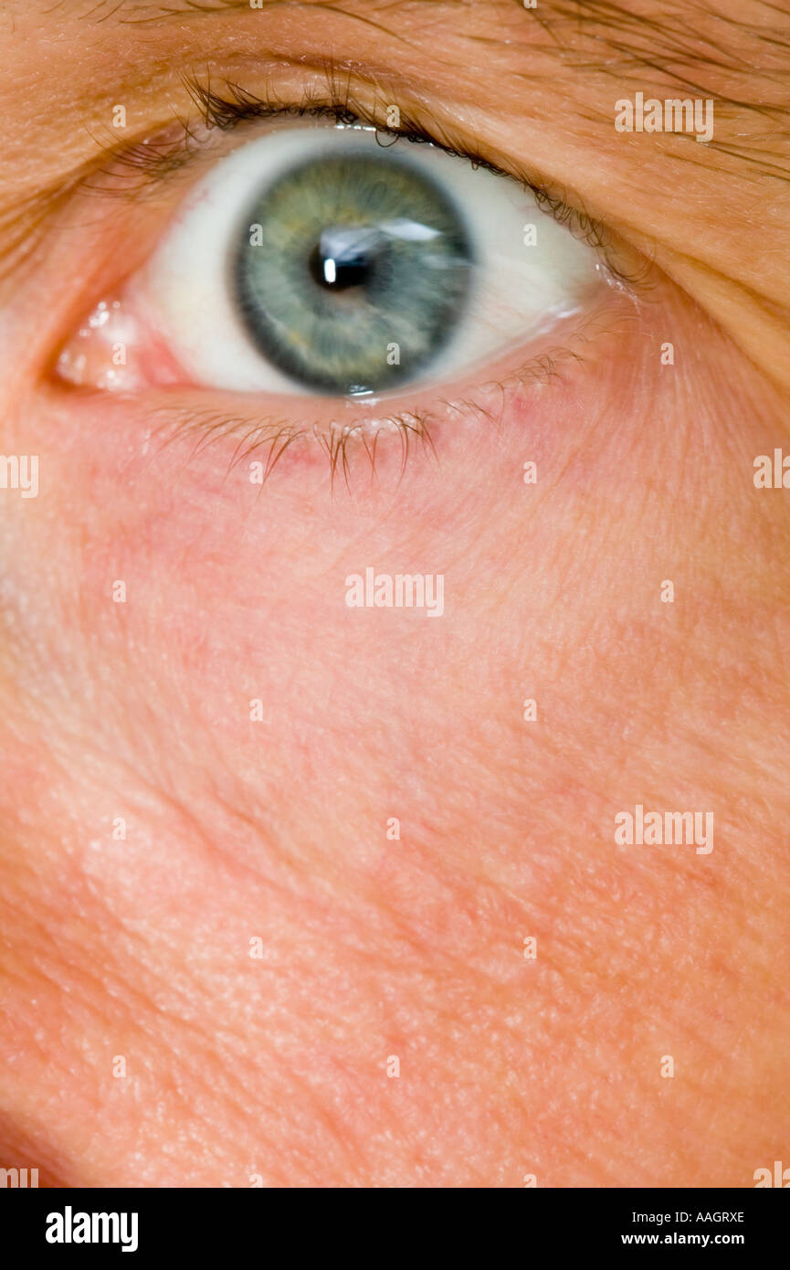 a mans eye Stock Photo - Alamy