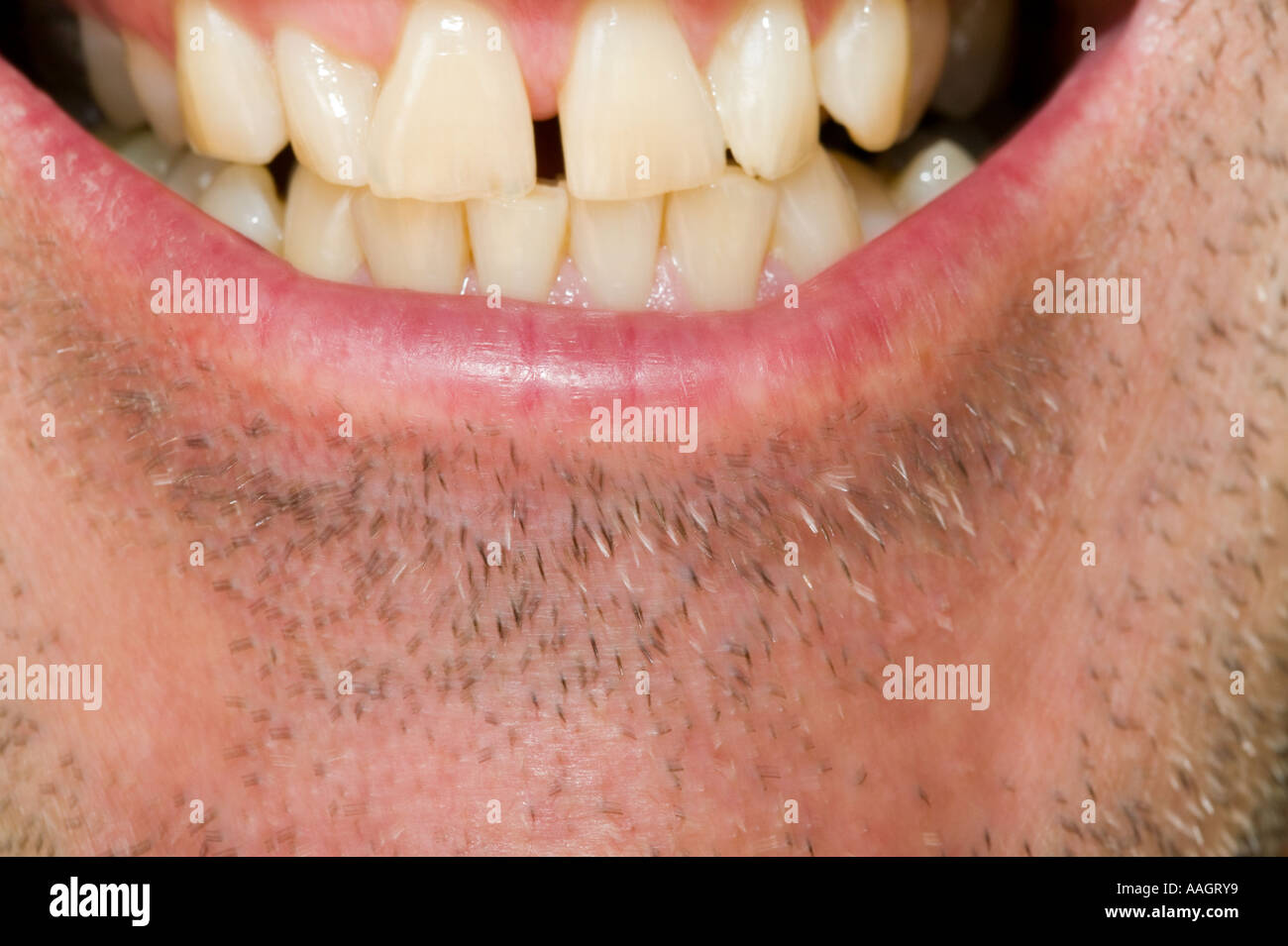 mouth of an unshaven man smiling and showing teeth Stock Photo - Alamy