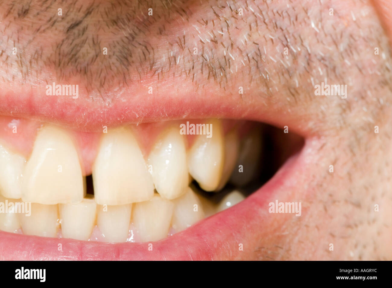 Man tooth gap hi-res stock photography and images - Alamy