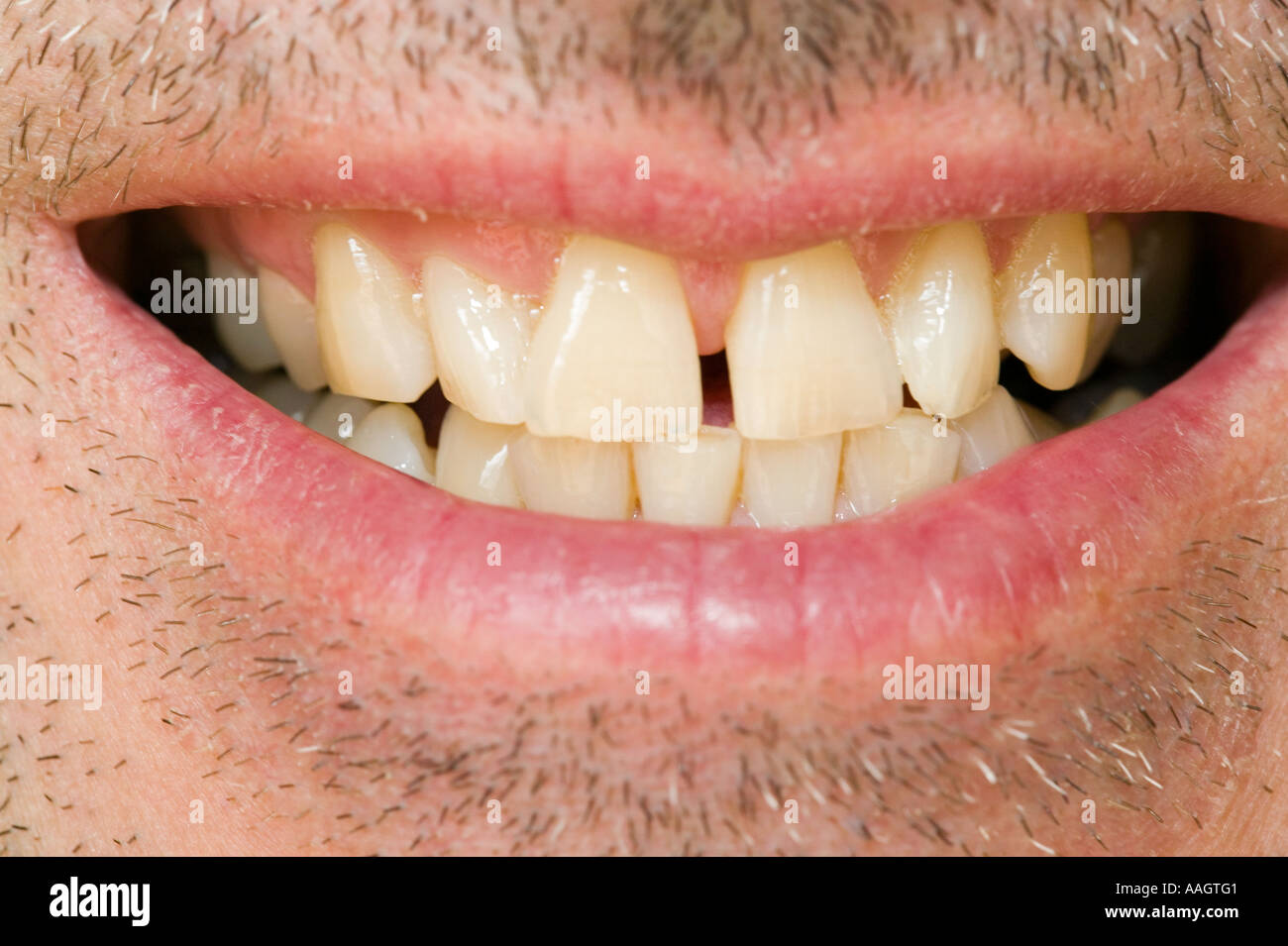 mouth of an unshaven man smiling and showing teeth Stock Photo - Alamy