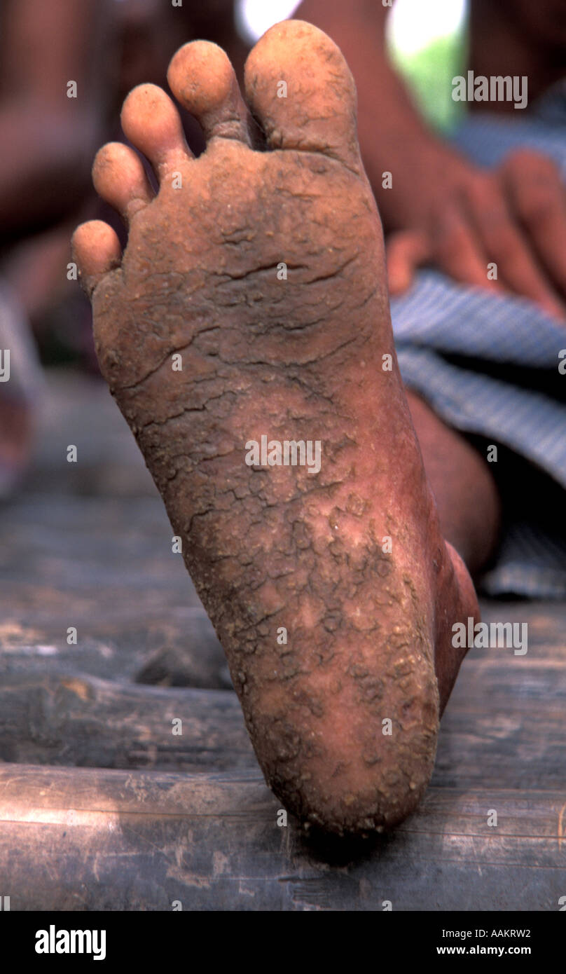 Rural Life – Cracking Open, Pain and Suffering - ‘Devil’s Water ...