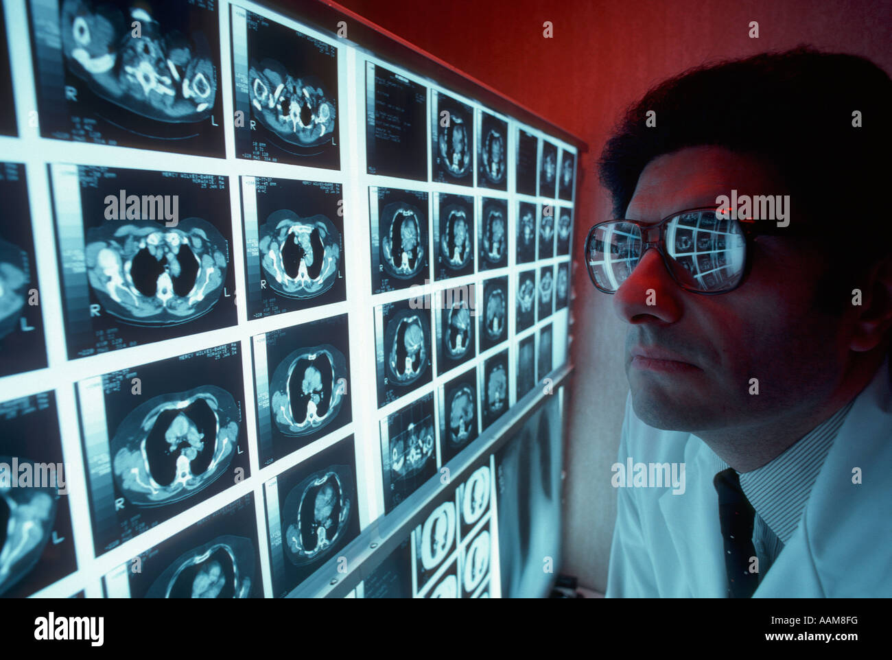 Cat scan brain axial section hi-res stock photography and images - Alamy