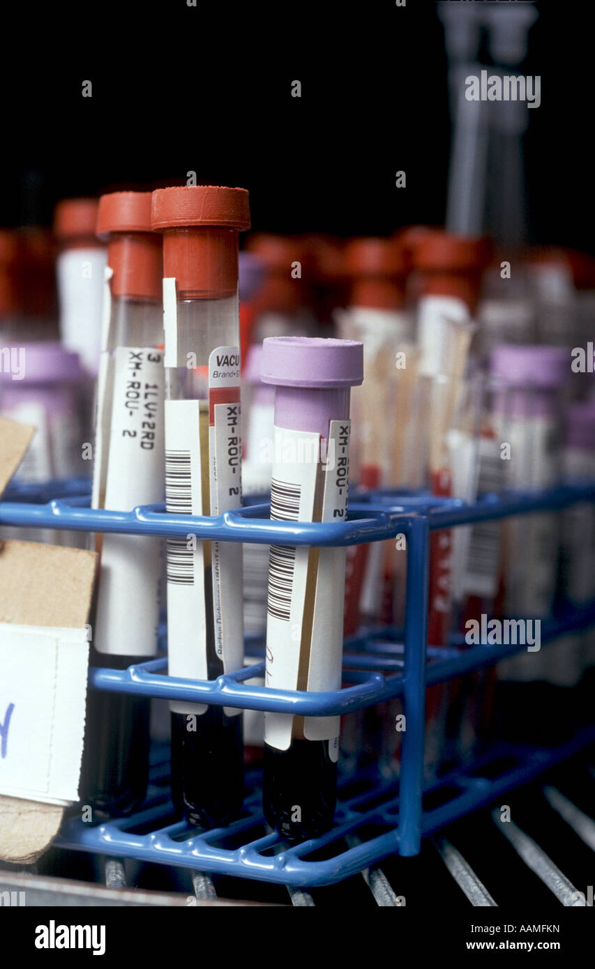 Blood samples in laboratory cooler Stock Photo - Alamy