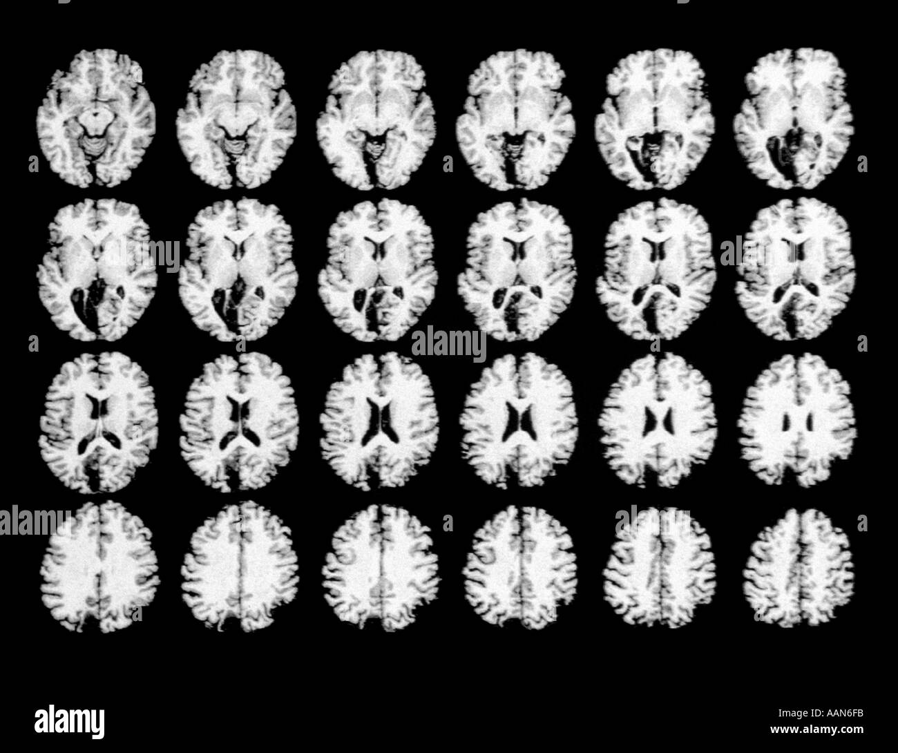 Brain Section Series Stock Photo - Alamy