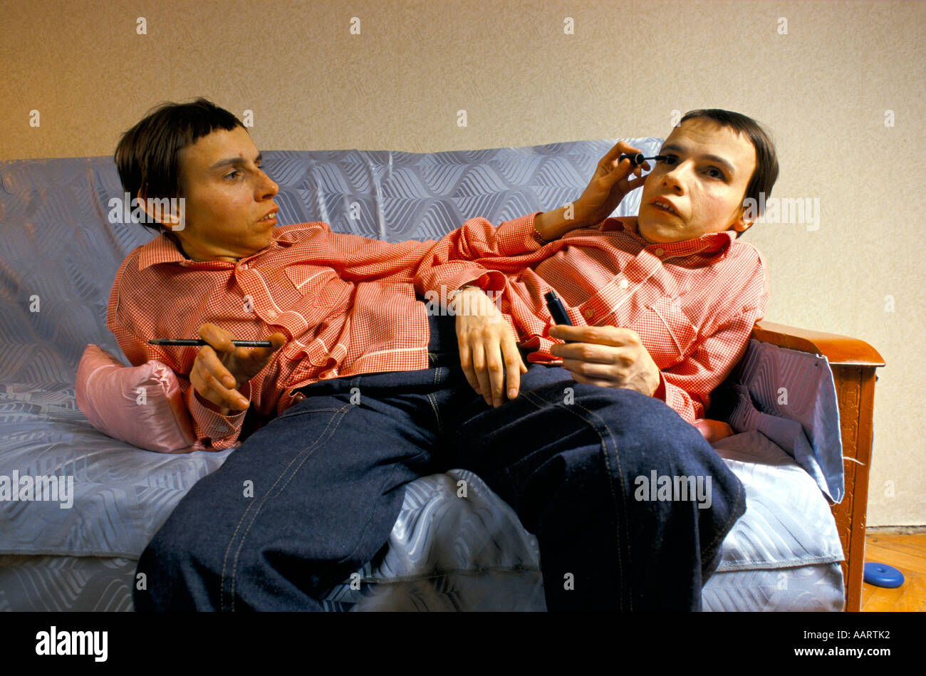 Russian conjoined twins Masha and Dasha Krivoshlyapova in Moscow Stock ...