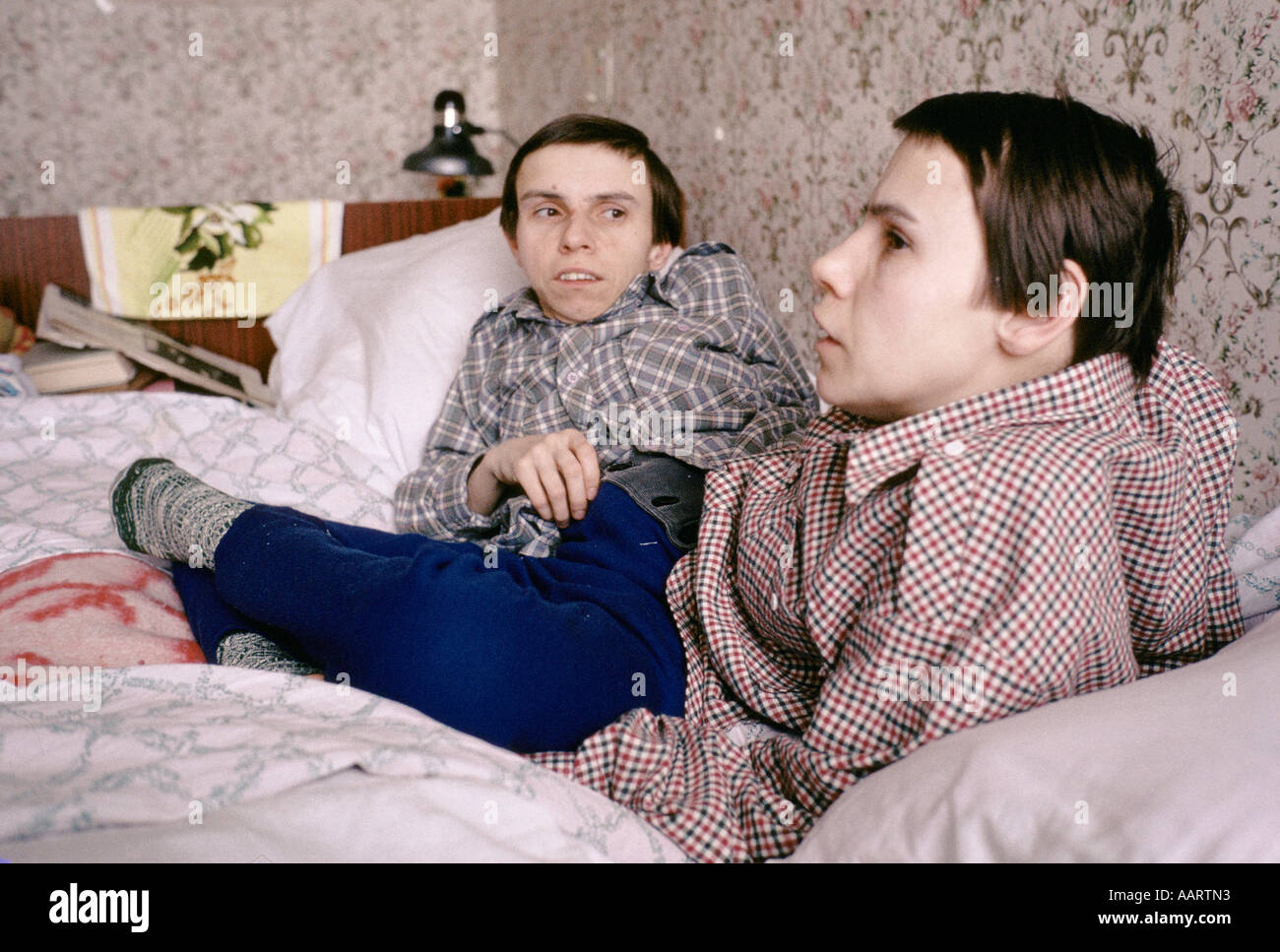 Russian conjoined twins Masha and Dasha Krivoshlyapova in Moscow Stock ...