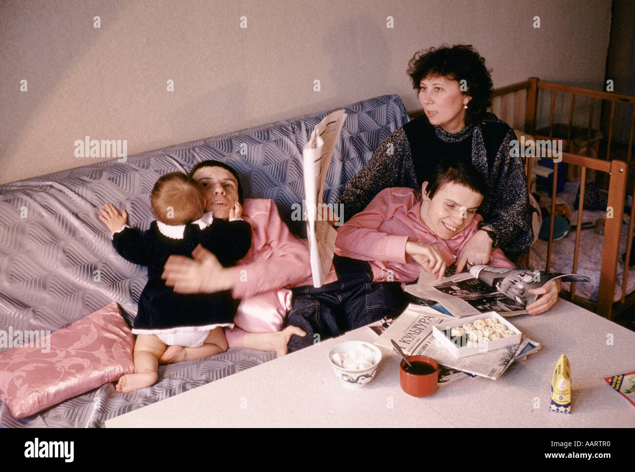 Russian conjoined twins Masha and Dasha Krivoshlyapova in Moscow Stock ...