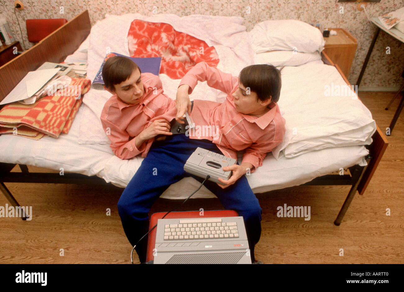 Russian conjoined twins Masha and Dasha Krivoshlyapova in Moscow Stock ...