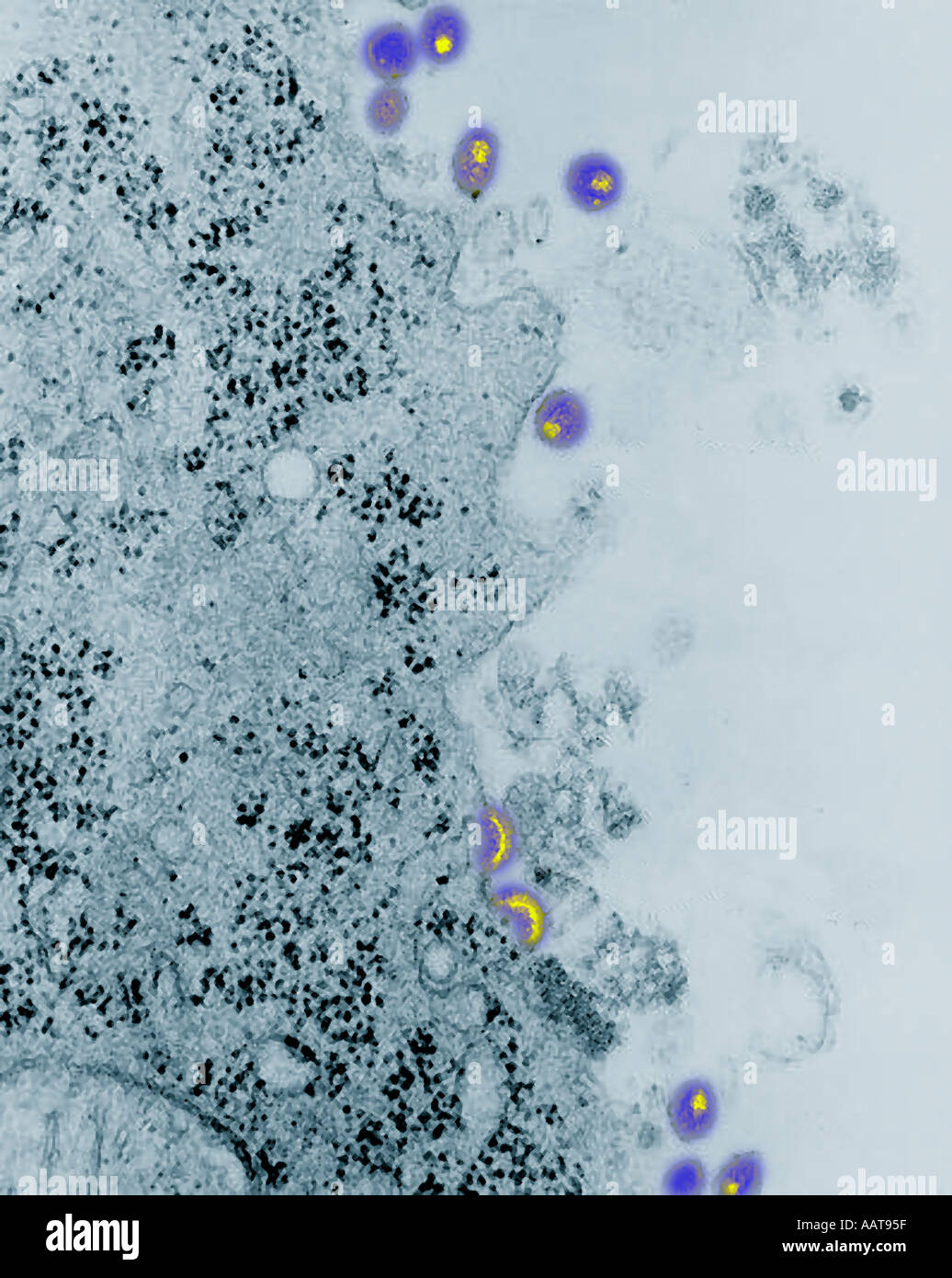 Transmission electron micrograph of HIV 1 virus particles budding and ...